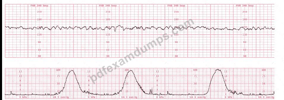 EFM：最新的NCC認證EFM考題，Certified - Electronic Fetal Monitoring認證